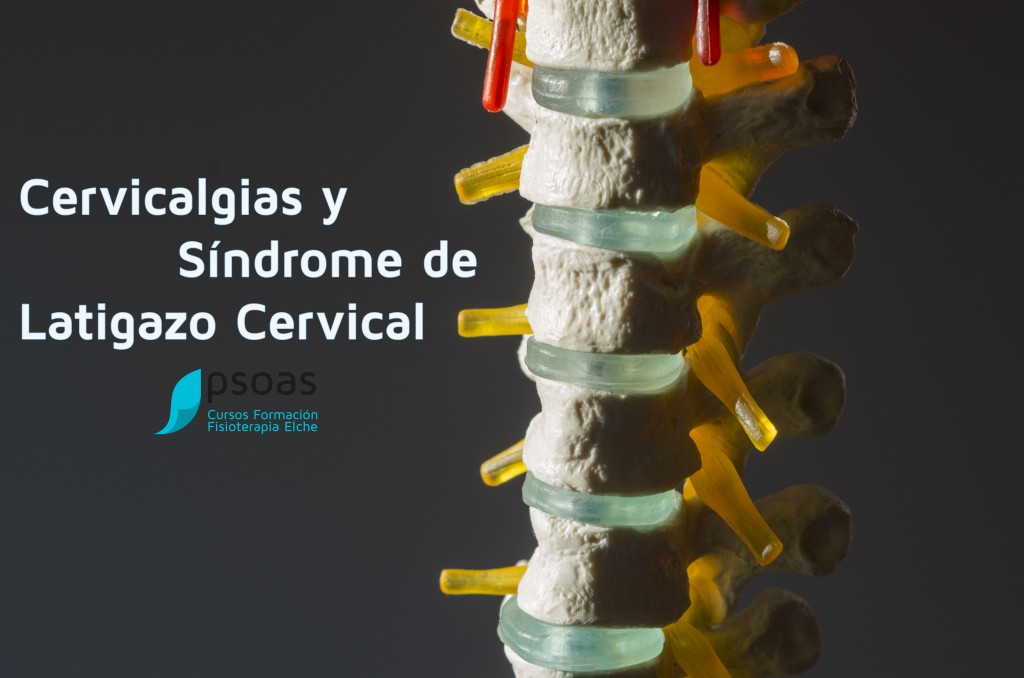 El Síndrome de Latigazo Cervical no solo afecta al cuello